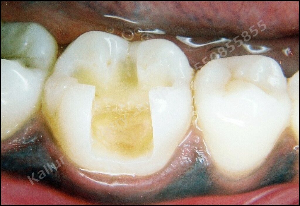 Gallery – Kallur Dentistry